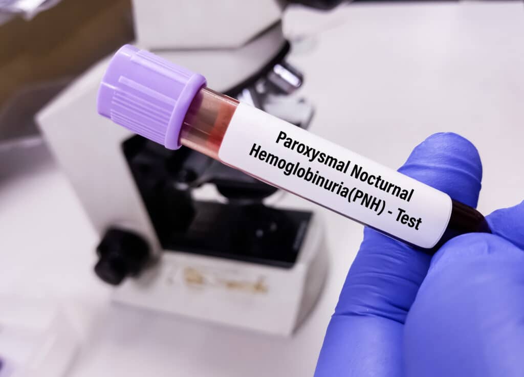 Understanding Paroxysmal Nocturnal Hemoglobinuria (PNH) - Medicaregate