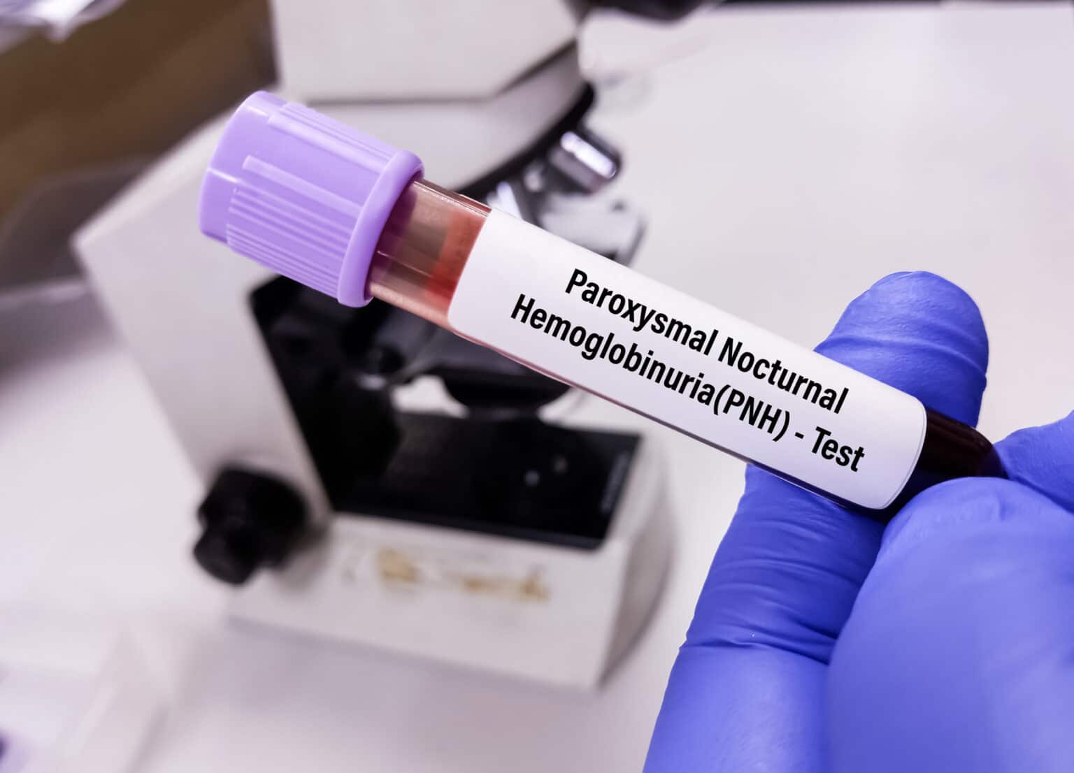Understanding Paroxysmal Nocturnal Hemoglobinuria (PNH) - Medicaregate